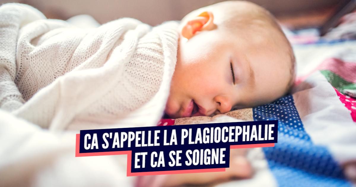 Top 10 des trucs à savoir sur le syndrome de la tête plate